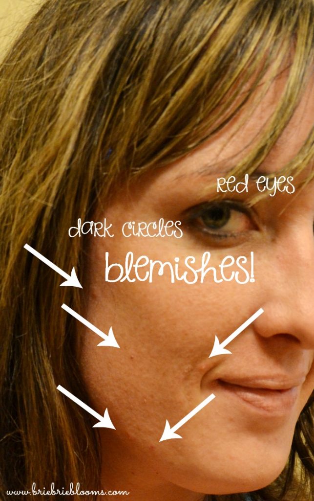 Tips to clear skin - in home blue light therapy for acne - Brie Brie Blooms